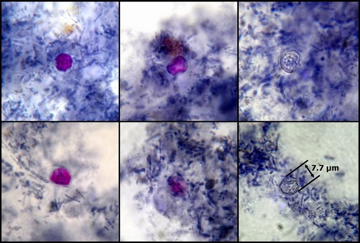 Fun With Microbiology (What's Buggin' You?): Cyclospora cayetanensis