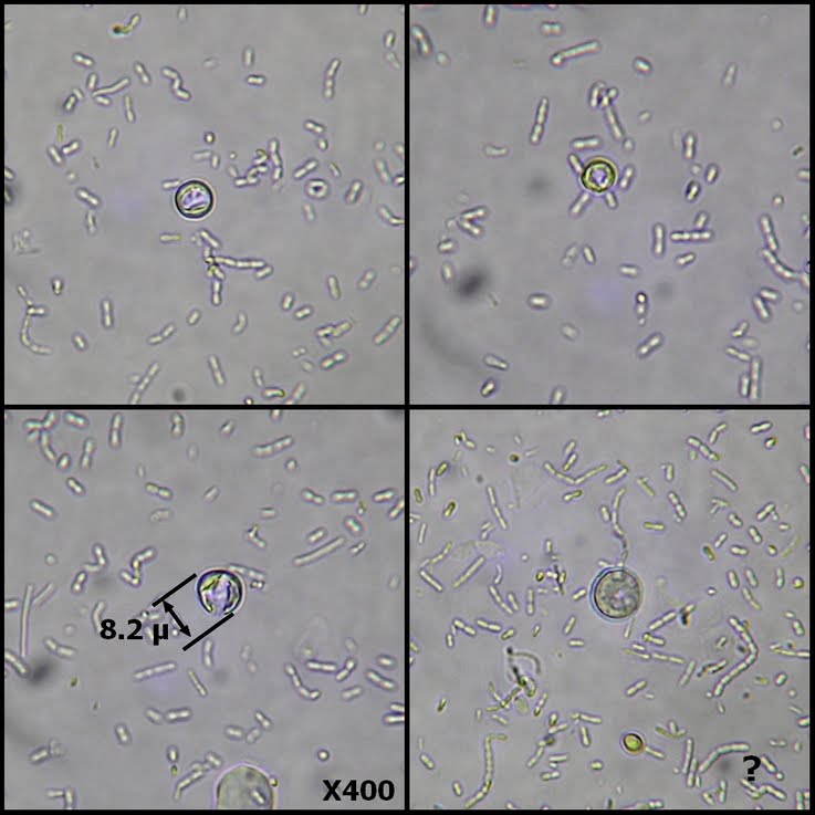 Fun With Microbiology (What's Buggin' You?): Cyclospora cayetanensis