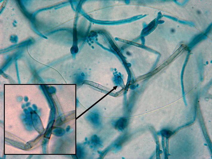 Fun With Microbiology (What's Buggin' You?): Phialophora varrucosa