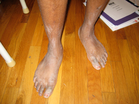 The Epidemic of Ashiness! | Ask Mr. Wrong