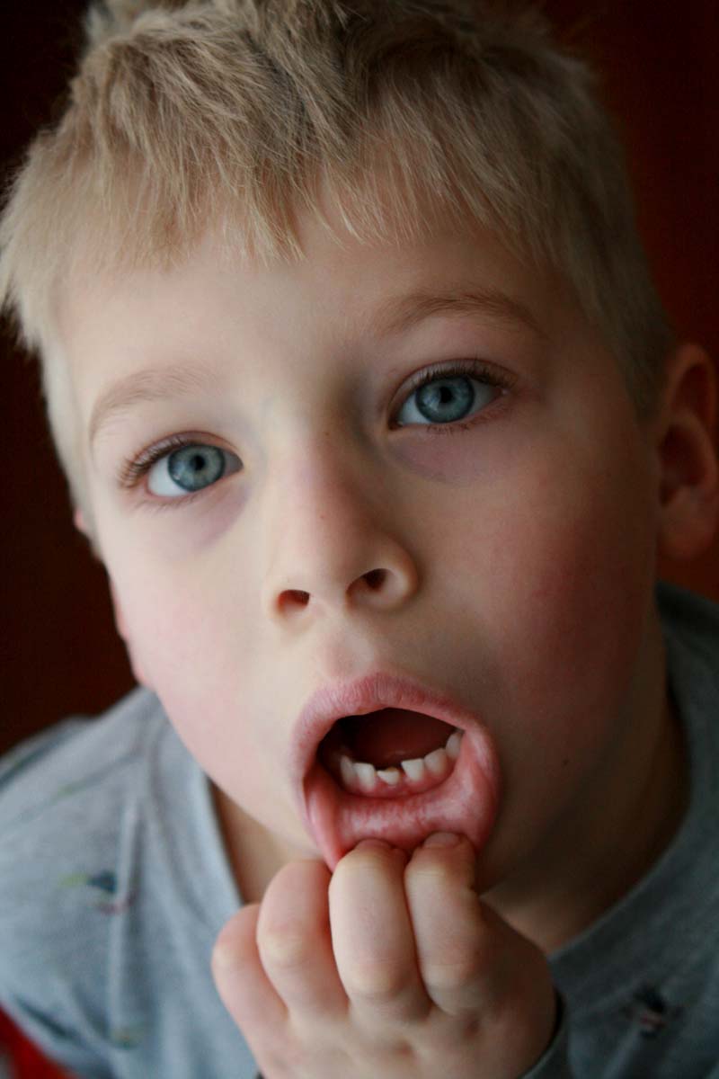 The Collins Journey: Loose tooth update