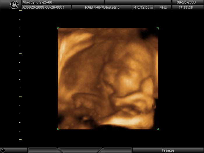 Baby Powell: 4d Ultrasound:
