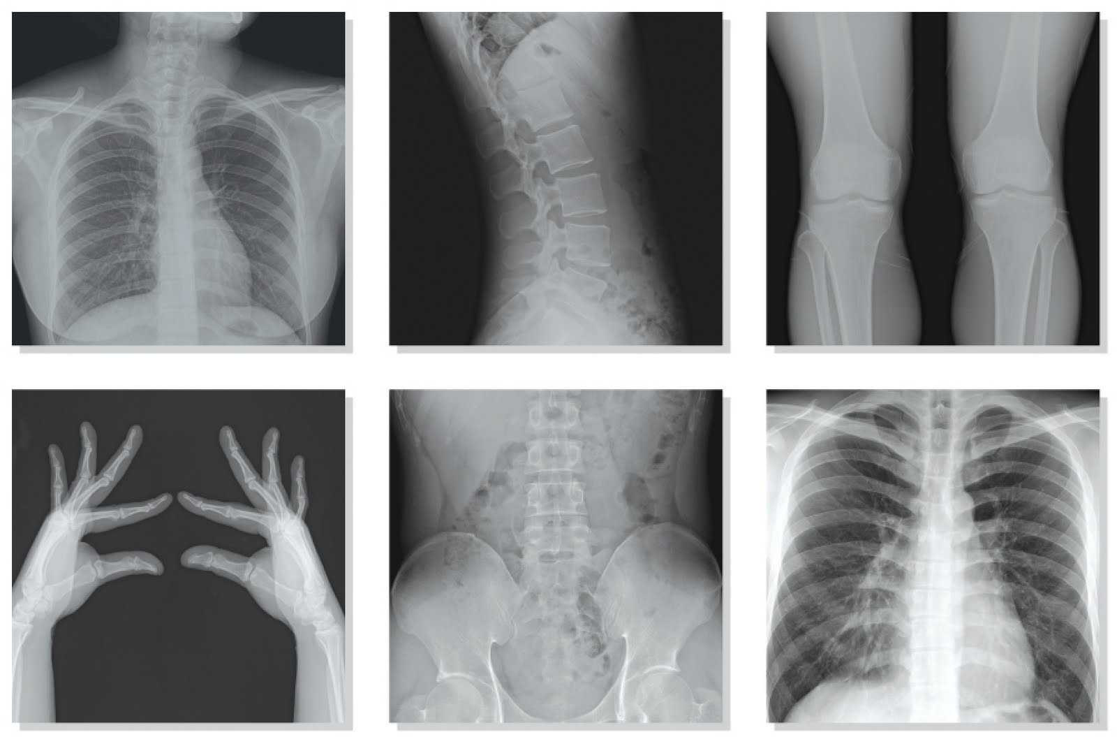 Inge Ray S.R.L.: Imágenes de Radiología Digital