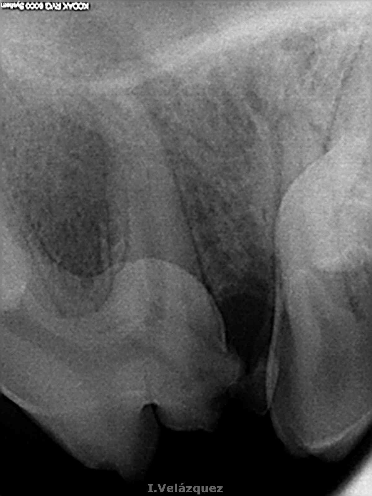 ODONTOVET: Absceso periapical 208