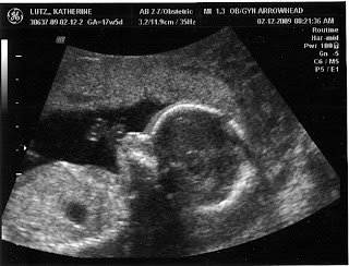 new: Our 18 week Ultrasound Pictures