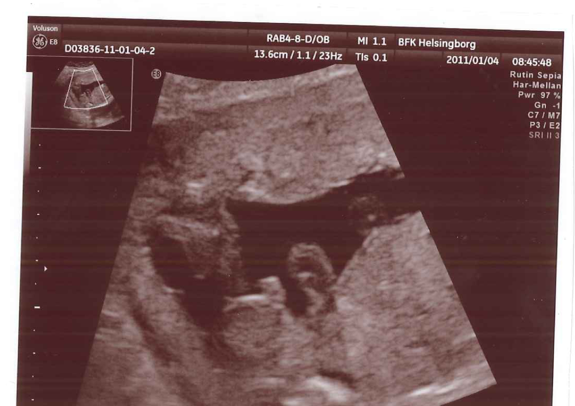 Agility Vilda med flock: Ultraljud