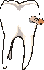 Odontologia Villa Luzuriaga: Causas de las caries