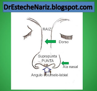 Dr Esteche | Rinoplastia | Cirugía | Plástica de Nariz | Nose |Surgery ...