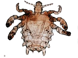 ETS ♀ ♂: Piojo del pubis o ladillas