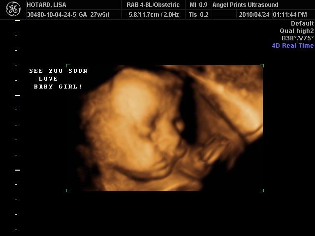 You Could Always Adopt. . .: Baby girl - 27 week 4d ultrasound