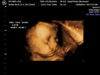 You Could Always Adopt. . .: Baby girl - 27 week 4d ultrasound
