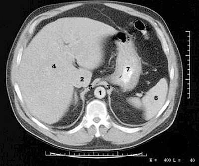 CT PHYSICS 09: Cross-sectional CT images of the abdomen