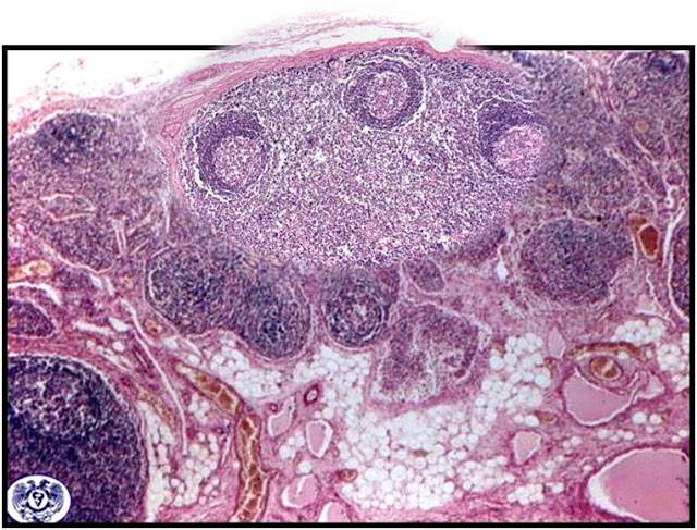 SOS BIOLOGIA CELULAR Y TISULAR: LINFOIDE