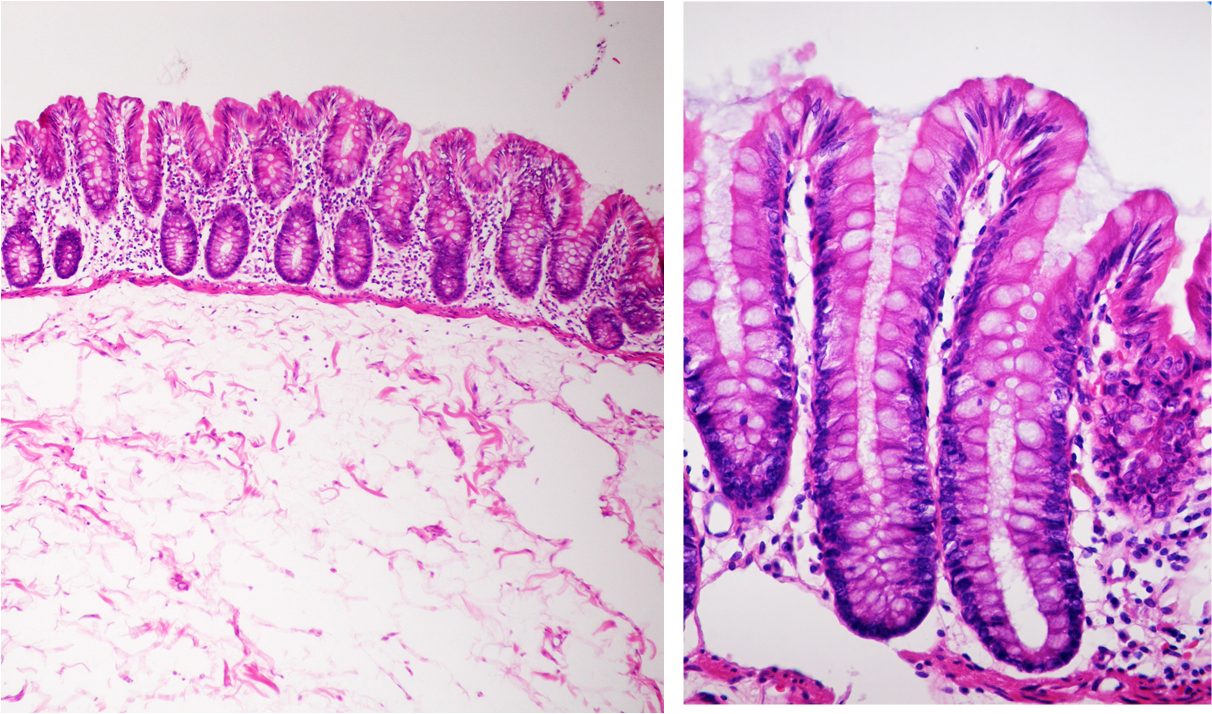 SOS BIOLOGIA CELULAR Y TISULAR: DIGESTIVO. Histology of the digestive ...
