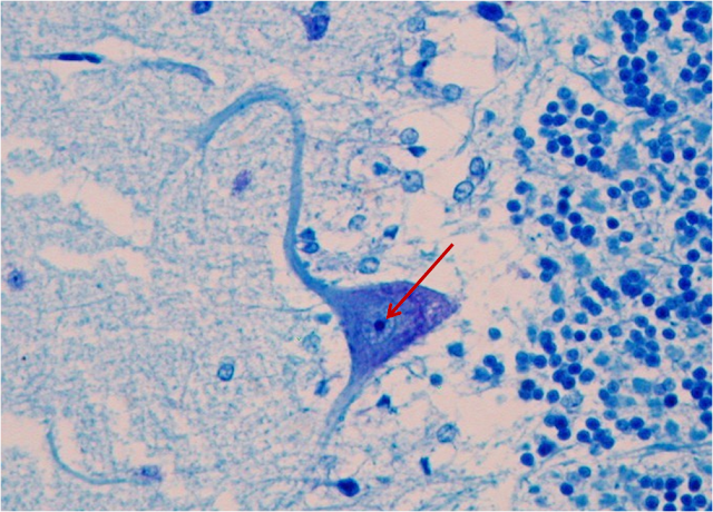 SOS BIOLOGIA CELULAR Y TISULAR: NUCLEO. NUCLEOLO