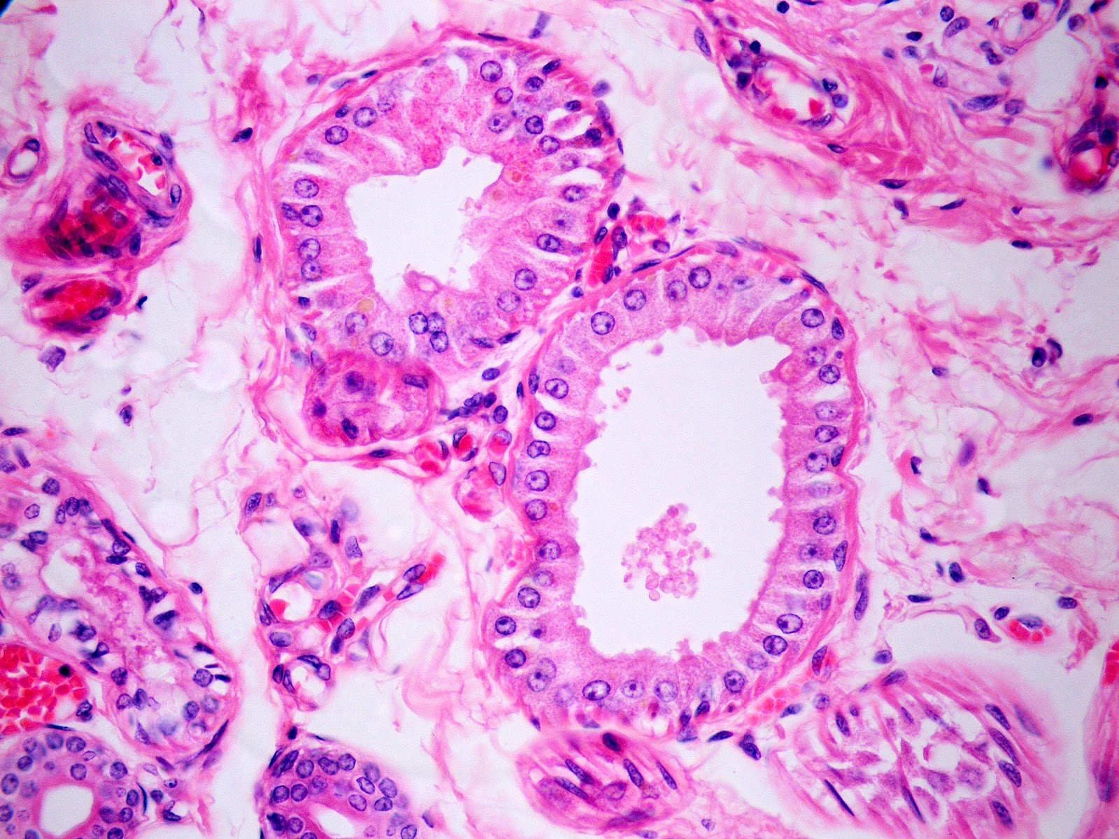 SOS BIOLOGIA CELULAR Y TISULAR: TEJIDOS. EPITELIOS.GLANDULA SUDORIPARA