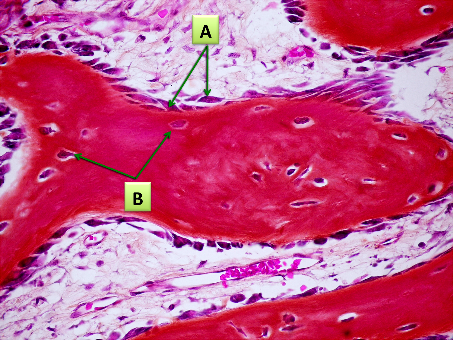 SOS BIOLOGIA CELULAR Y TISULAR: TEJIDOS. OSEO. CELULAS