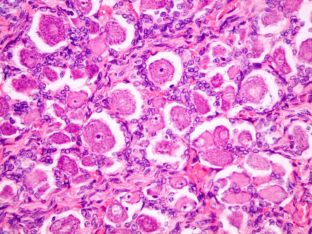 SOS BIOLOGIA CELULAR Y TISULAR: TEJIDO NERVIOSO. GANGLIO