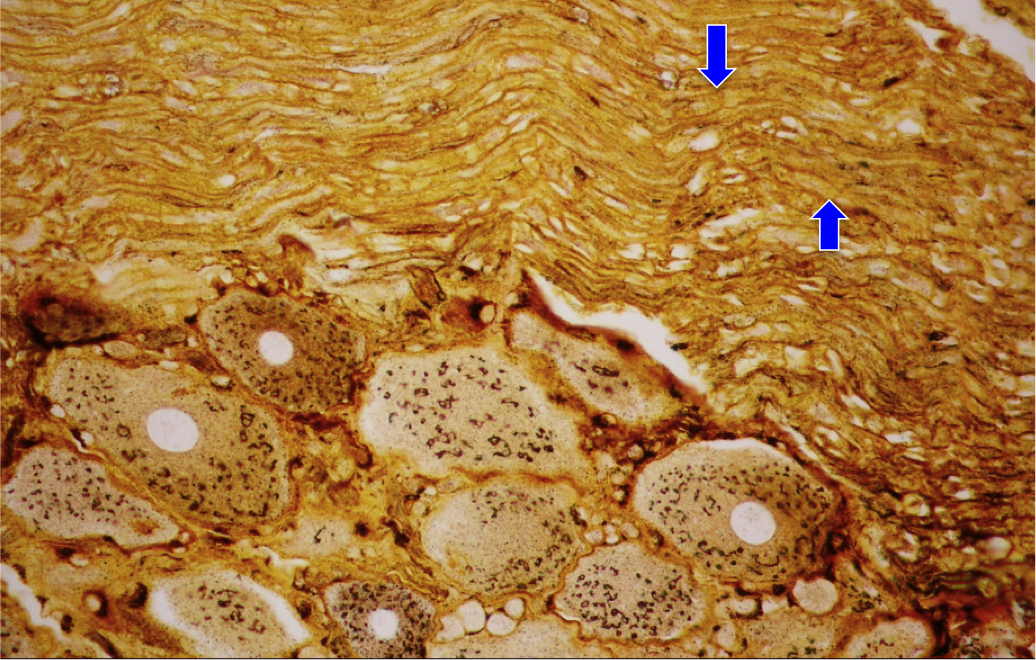 SOS BIOLOGIA CELULAR Y TISULAR: TEJIDO NERVIOSO. GANGLIO RAQUIDEO