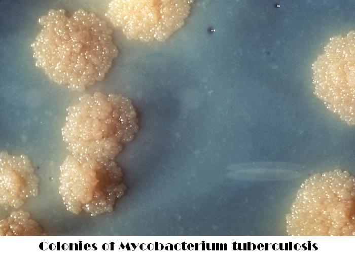 Types of Mycobacteria: Types of Mycobacteria