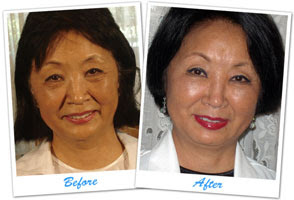 LifeCell - Skin Care and Anti Aging Treatment: LifeCell Skin Care ...