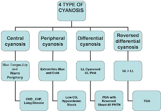 Medical Information Center: CYANOSIS