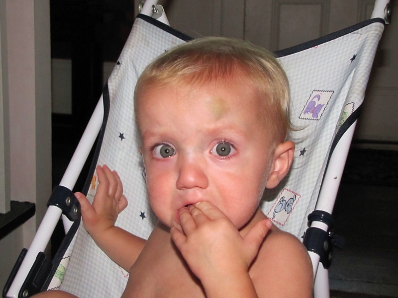 Four Plus an Angel: Bumps, bruises and other stuff :)