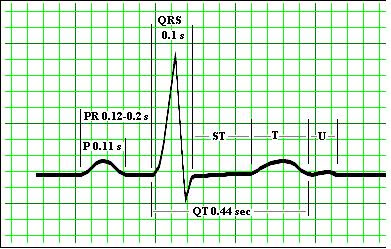 monsi@intensity_06: Electrocardiogram (ECG) Reading