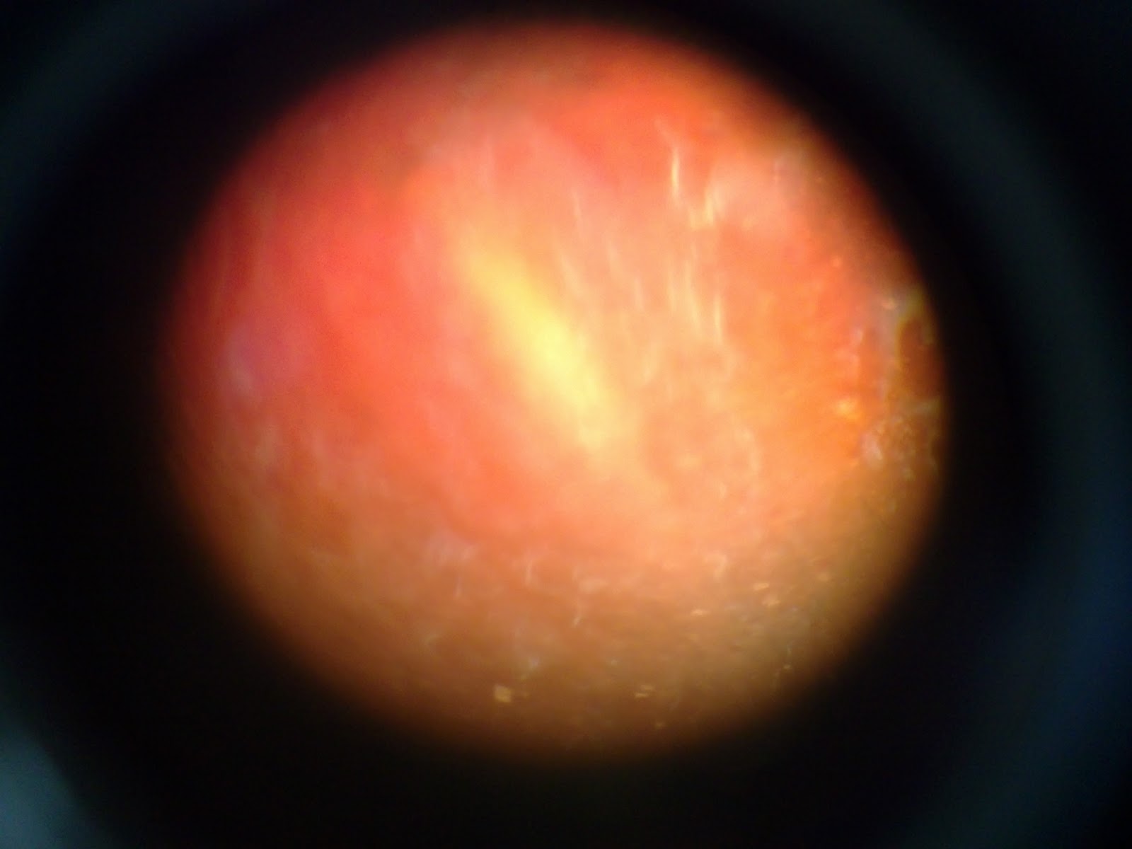 Biology 11 Winnie Dai: How does a strawberry look like inside a microscope?