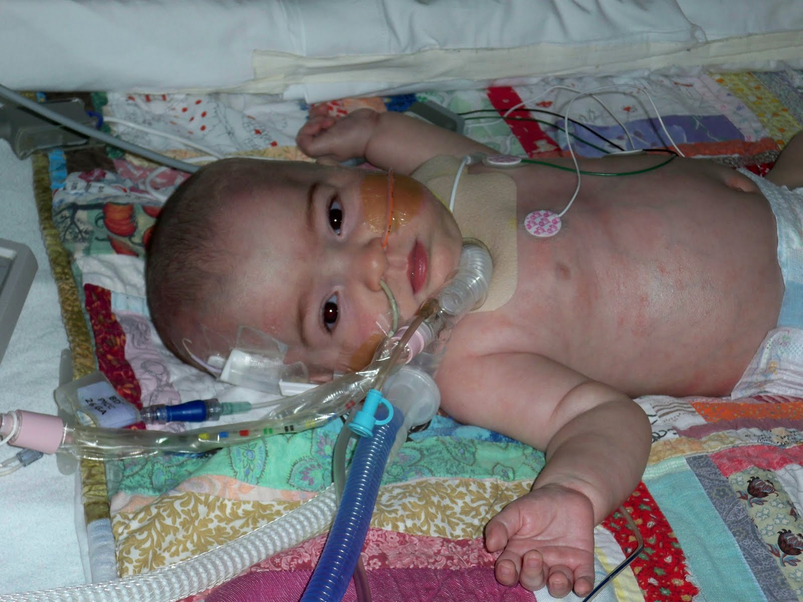 Byrne Family... of five!: Trach Collar Trials - week TWO!