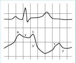 Cardiology secrets: Bedside Hemodynamic Monitoring Patient. What are ...