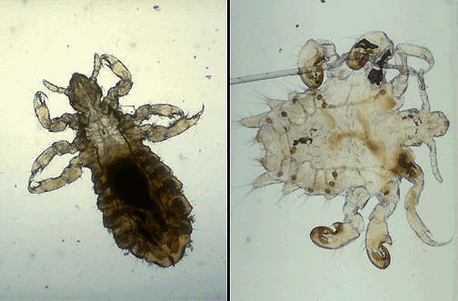 Mari Perangi Kutu Kepala