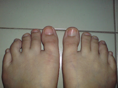 Little RAINBOW: Twisted Toe