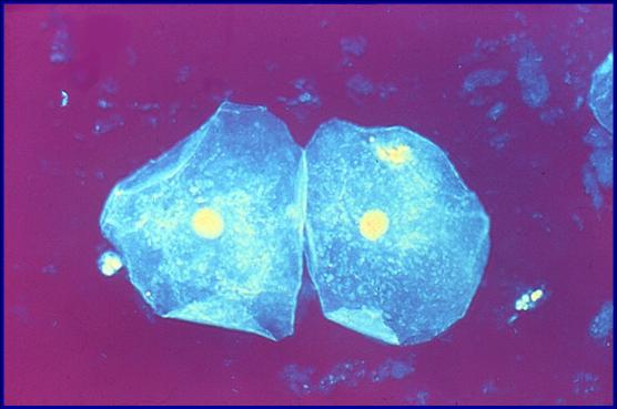 yNfOrMaTiik: [:[:[_Microscopía_]:]:]