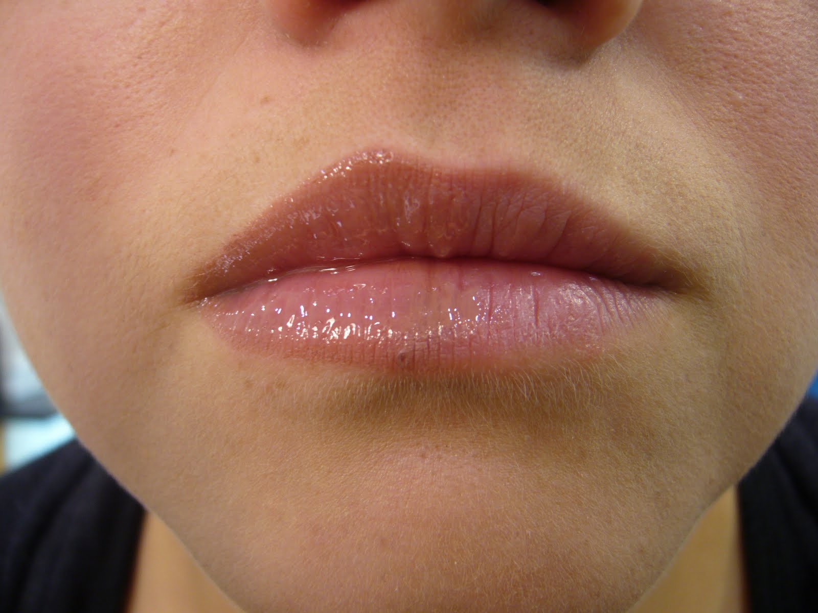 Labio; Filtrum; Surco Sublabial