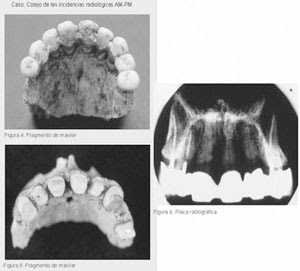 Ética y odontología legal: RUGOSCOPÍA