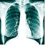 Imperchorstra: Punctured Lungs