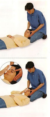 First Aid: First Aid for Eye Injury