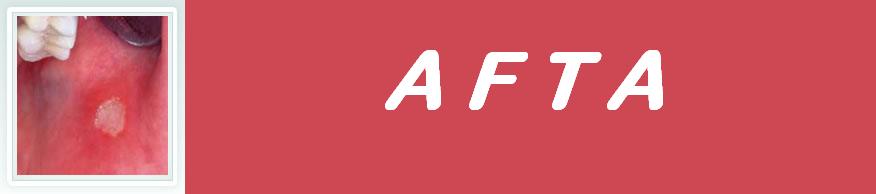 AFTA: Afta, cura, tratamento, de onde vem