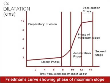 Dr. Alaa Mosbah, MD OBS & GYN: Contracted pelvis and cephalopelvic ...
