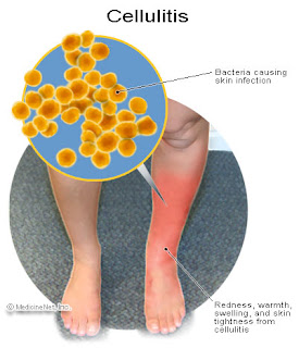 Health Tips / Articles / Advice