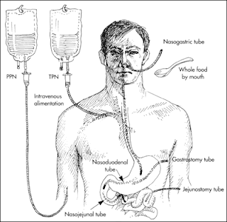 Enfermagem com AMOR!!: Manual O ENTERAL elaborado pela UNICAMP para os ...