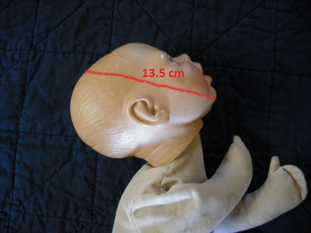 Natural Birth In Kitsap: Optimal Fetal Positioning, Part 2 - The Fetal Head