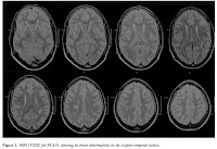 The Only Perception: How Important is Color?