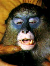 CADA DIA HAY MAS INFECTADOS DEL VIH: ¿Cuándo, Dónde y Cómo surgió el SIDA?