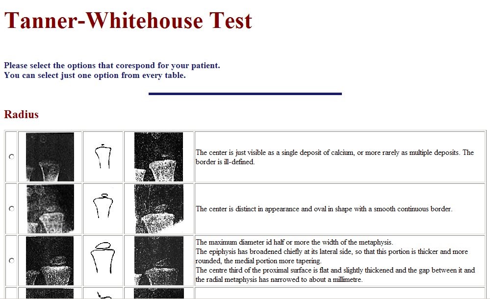 Radiología Oral y Maxilofacial: Método Tanner Whitehouse 2