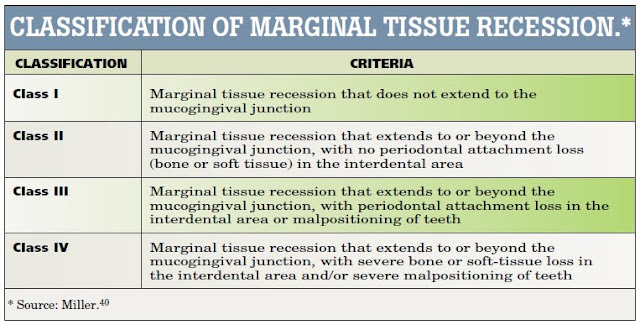 The etiology and prevalence of gingival recession | Perio and Implant ...