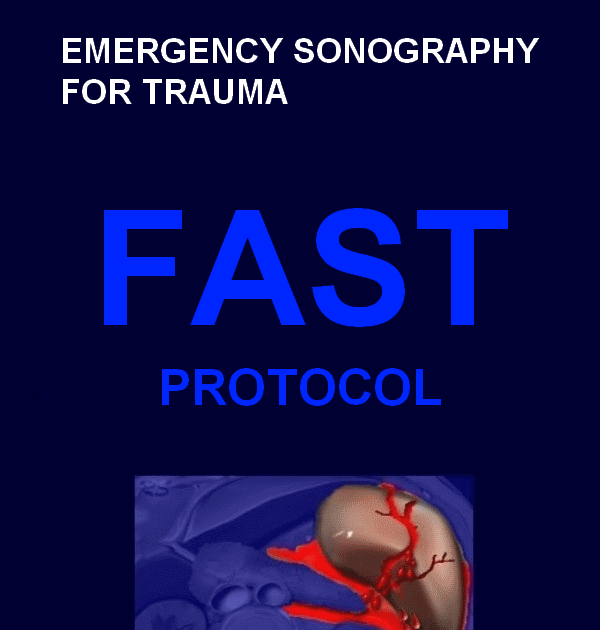 SONOMIR: EMERGENCY SONOGRAPHY FOR TRAUMA - FAST PROTOCOL