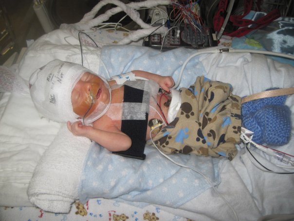At a glance...: Life in the PCH NICU 11-3-09 to 12-24-09