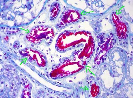 TRANSPORTE DE PROTEINAS: LA MIOGLOBINA